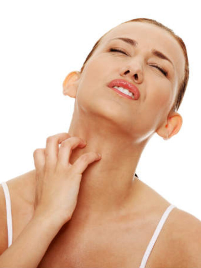 How to prevent heat rashes in summer How to prevent heat rashes in summer