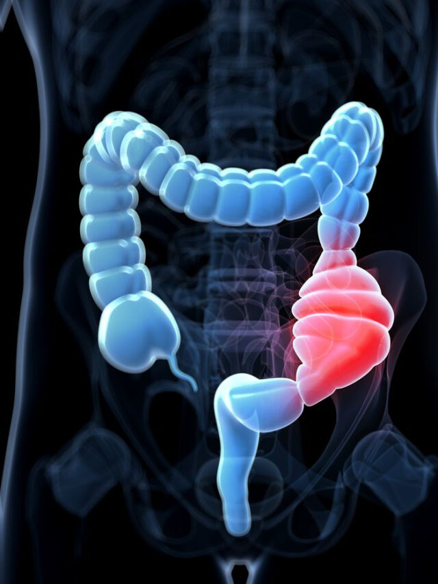 சார்பிடால்.. மலச்சிக்கல் பிரச்சனையை சரி செய்ய பருக வேண்டிய ஜூஸ்கள்..!!