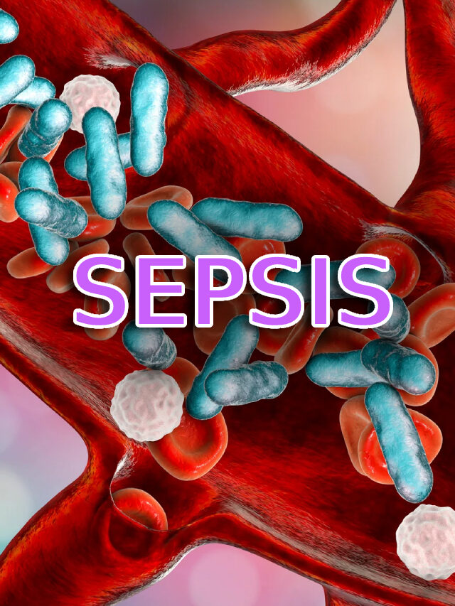 உயிருக்கு ஆபத்து ஏற்படுத்தக்கூடிய செப்சிஸ் பற்றி தெரியுமா..?