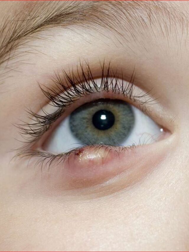 கண்கட்டி உடைய...இதை பூசுங்க தானே உடைஞ்சிடும்!