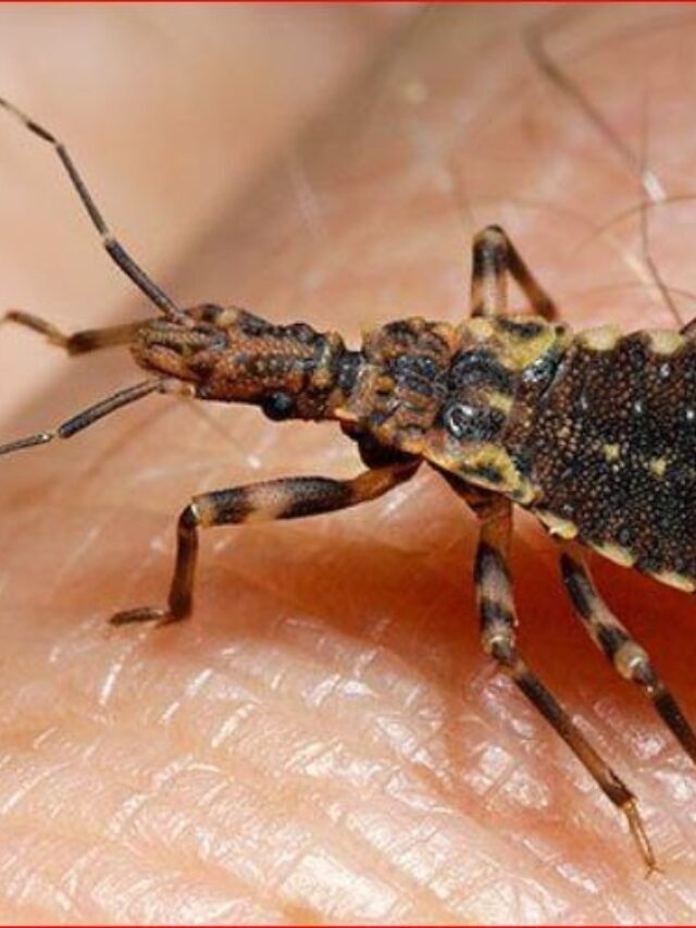 பூச்சி கடிக்கு டக்குனு இதை செய்யுங்க!